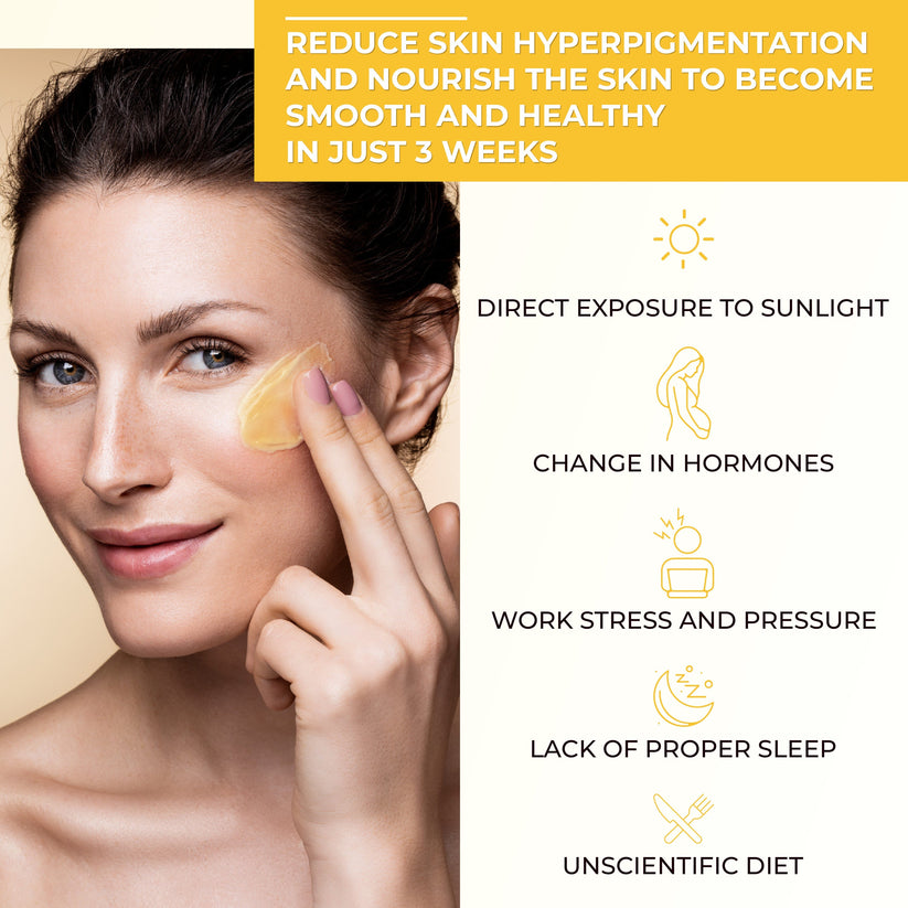 ABERA MELASMA CREAM 20G – HELPS FADE MELASMA, FRECKLES, AGE SPOTS, SMO ...